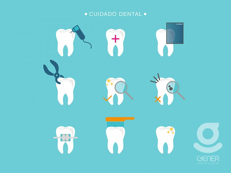 CARIES: TRATAMIENTO Y EMPASTE DENTAL - GENER | cirugía oral